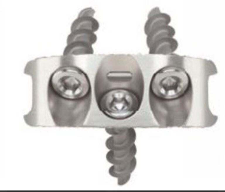 What is a ALIF TAS-Cage surgery! - Motion Preservation of the Spine